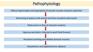Pyloric stenosis & Megacolon | PPT