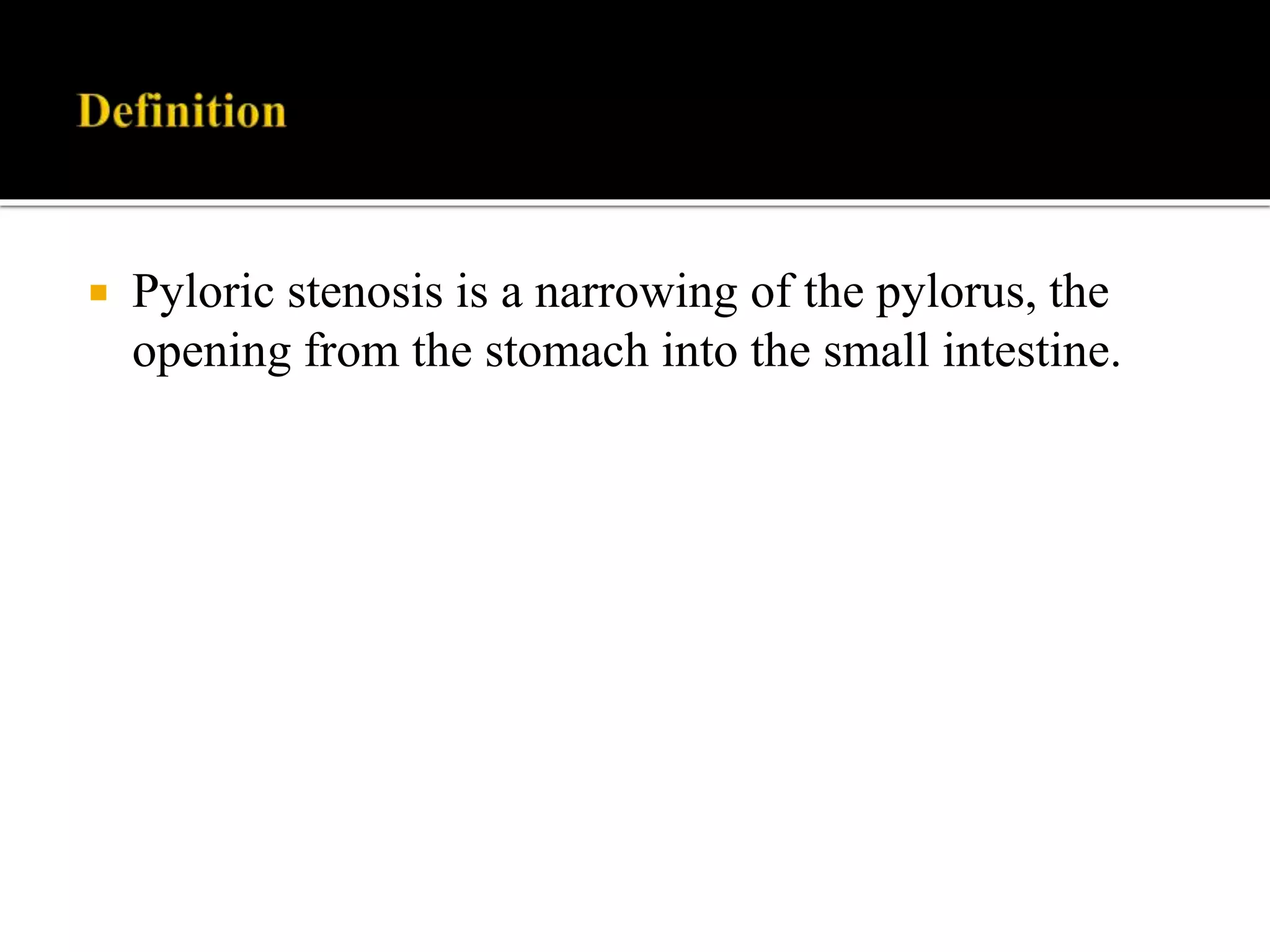 Pyloric stenosis notes | PPTX