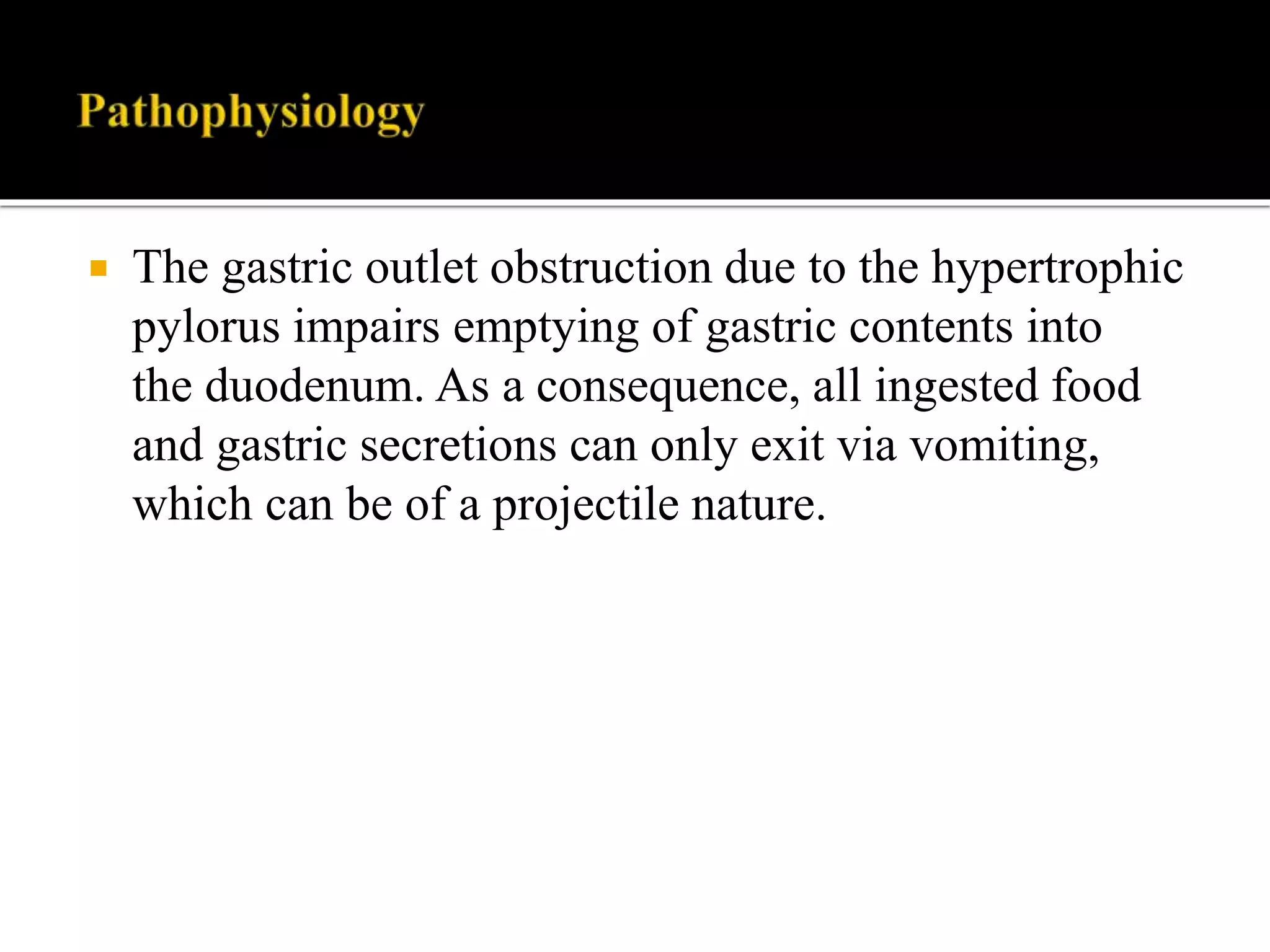 Pyloric stenosis notes | PPTX