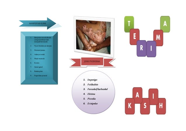 Pyoderma ganggrenosum | DOCX