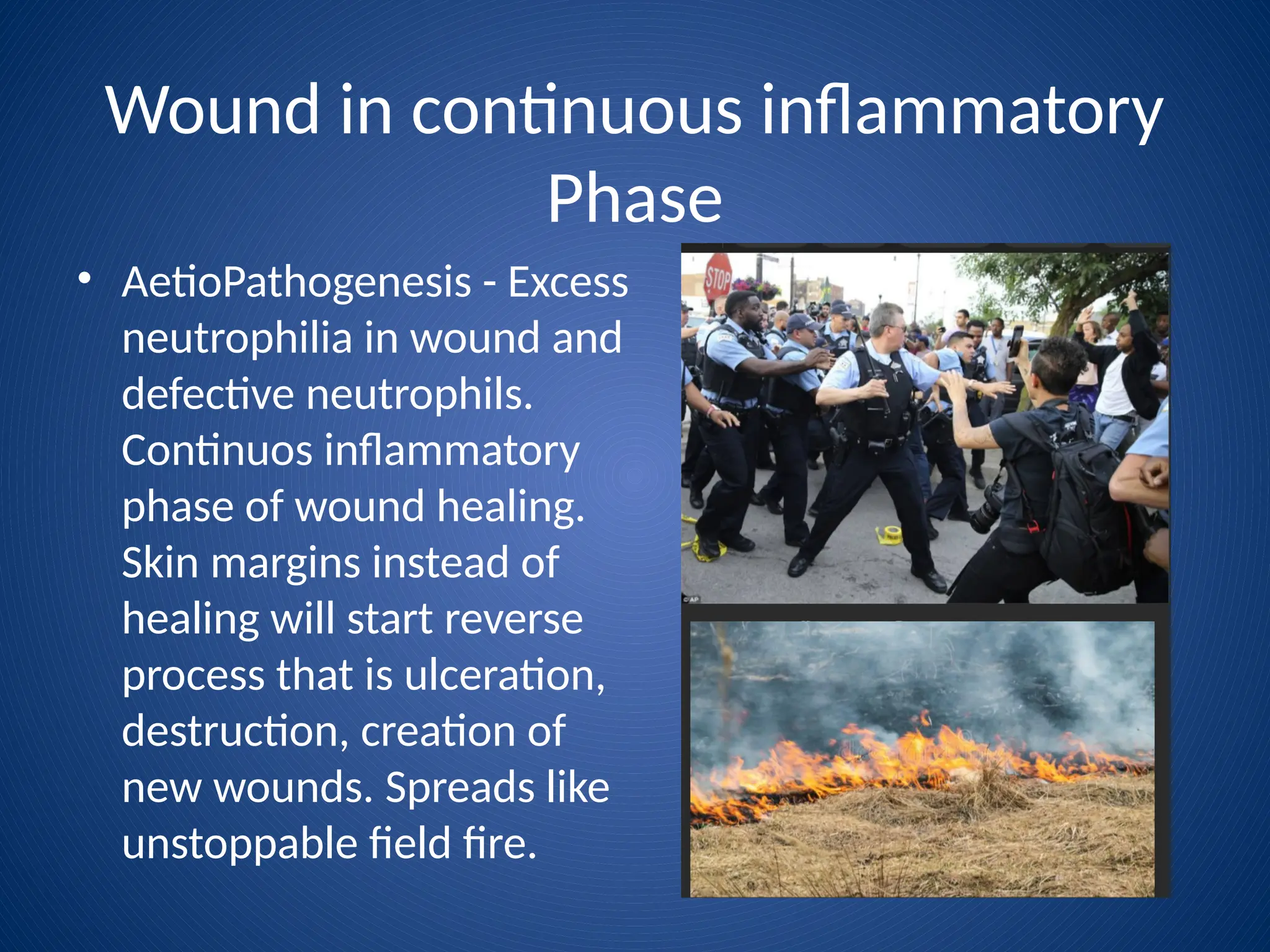 Pyoderma gangrenosum and Post Surgical Pyoderma Gangrenosum | PPTX