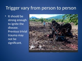 Pyoderma gangrenosum and Post Surgical Pyoderma Gangrenosum | PPTX