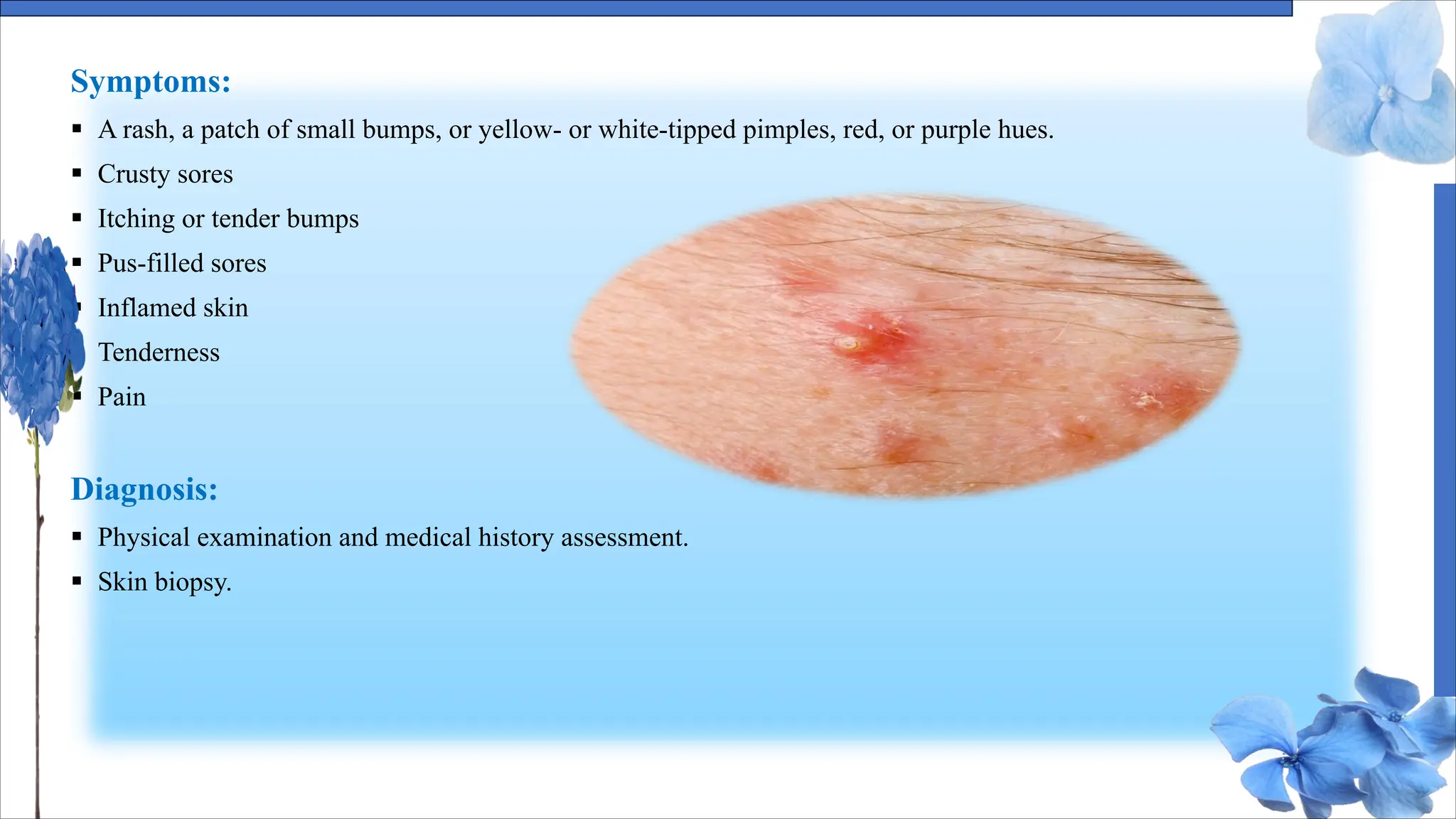 PYODERMA, IMPETIGO, FOLLICULITIS, FURUNCLES, CARBUNCLES.pdf