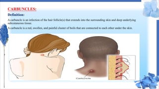 PYODERMA, IMPETIGO, FOLLICULITIS, FURUNCLES, CARBUNCLES.pdf