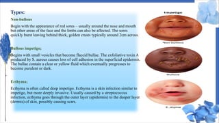 PYODERMA, IMPETIGO, FOLLICULITIS, FURUNCLES, CARBUNCLES.pdf