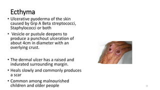 Pyodermas.pptx