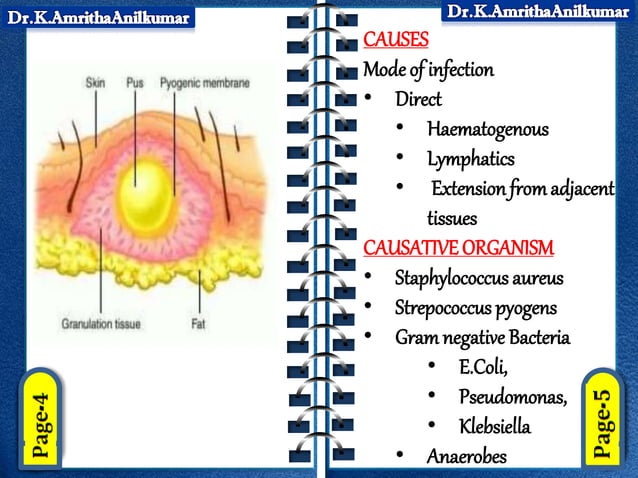 Pyogenic abscess by Dr.K.AmrithaAnilkumar | PPTX | Ear, Nose and Throat ...