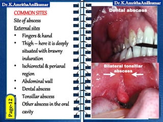 Pyogenic abscess by Dr.K.AmrithaAnilkumar | PPTX | Ear, Nose and Throat ...