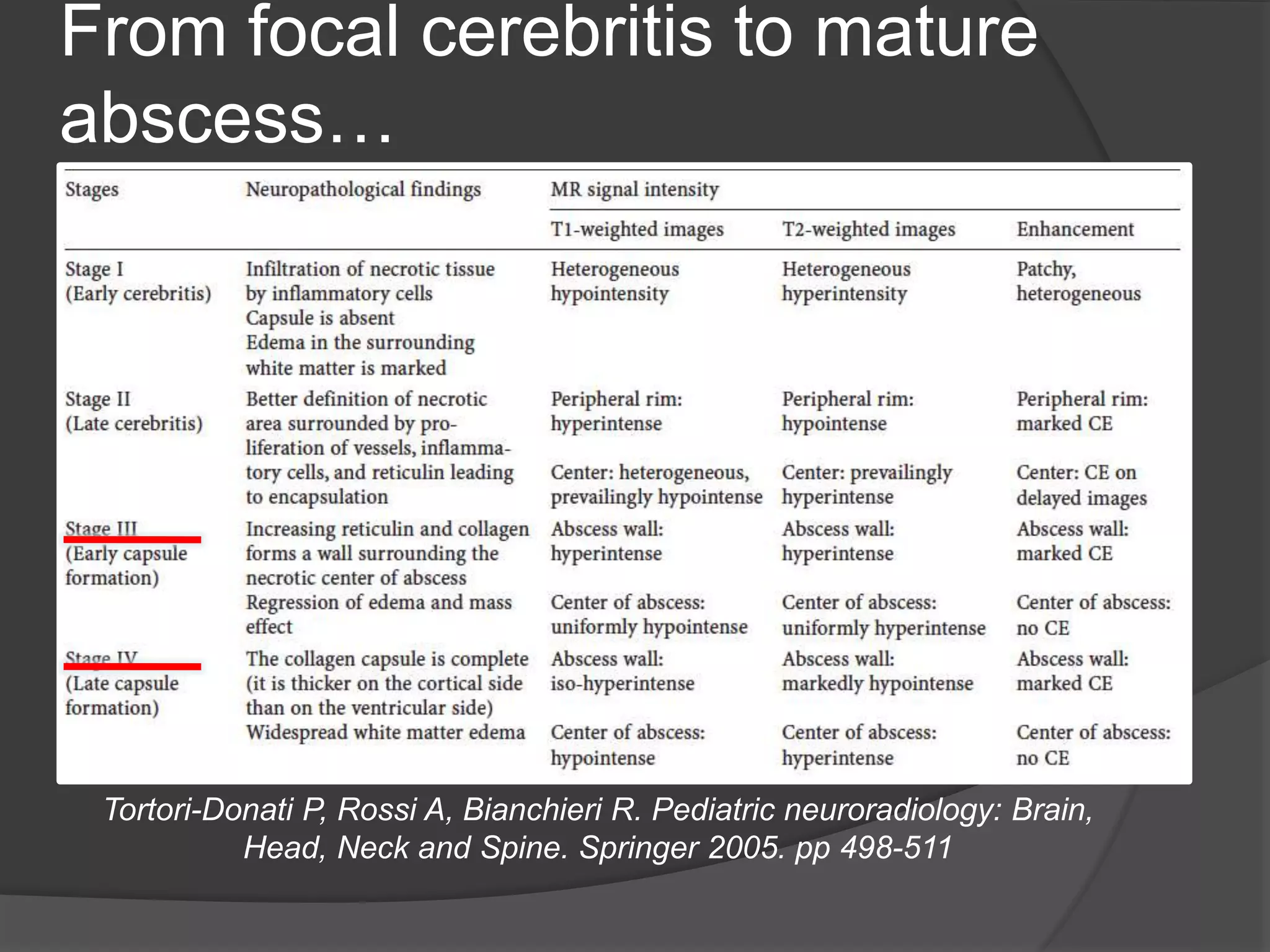 Magnetic resonance features of pyogenic brain abscesses and ...