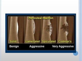 Pyogenic bone and joint infections | PPTX