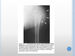 Pyogenic bone and joint infections | PPTX