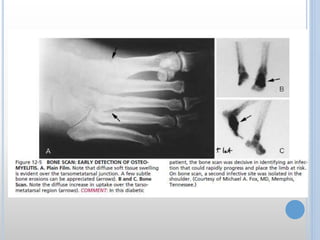 Pyogenic bone and joint infections | PPTX