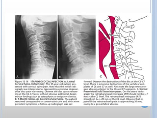 Pyogenic bone and joint infections | PPTX