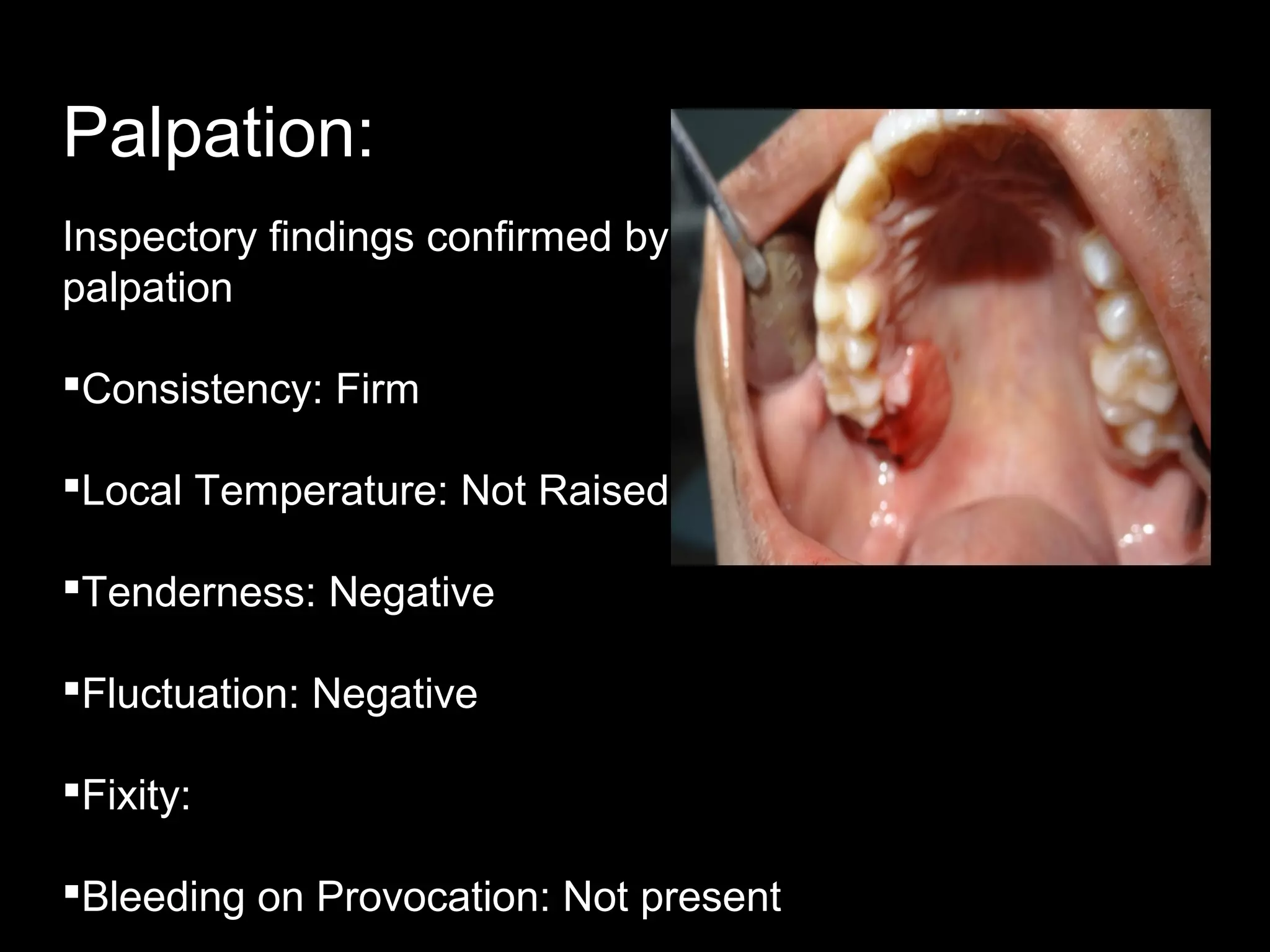 Pyogenic granuloma | PPT
