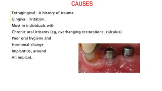 Pyogenic Granuloma | PPTX