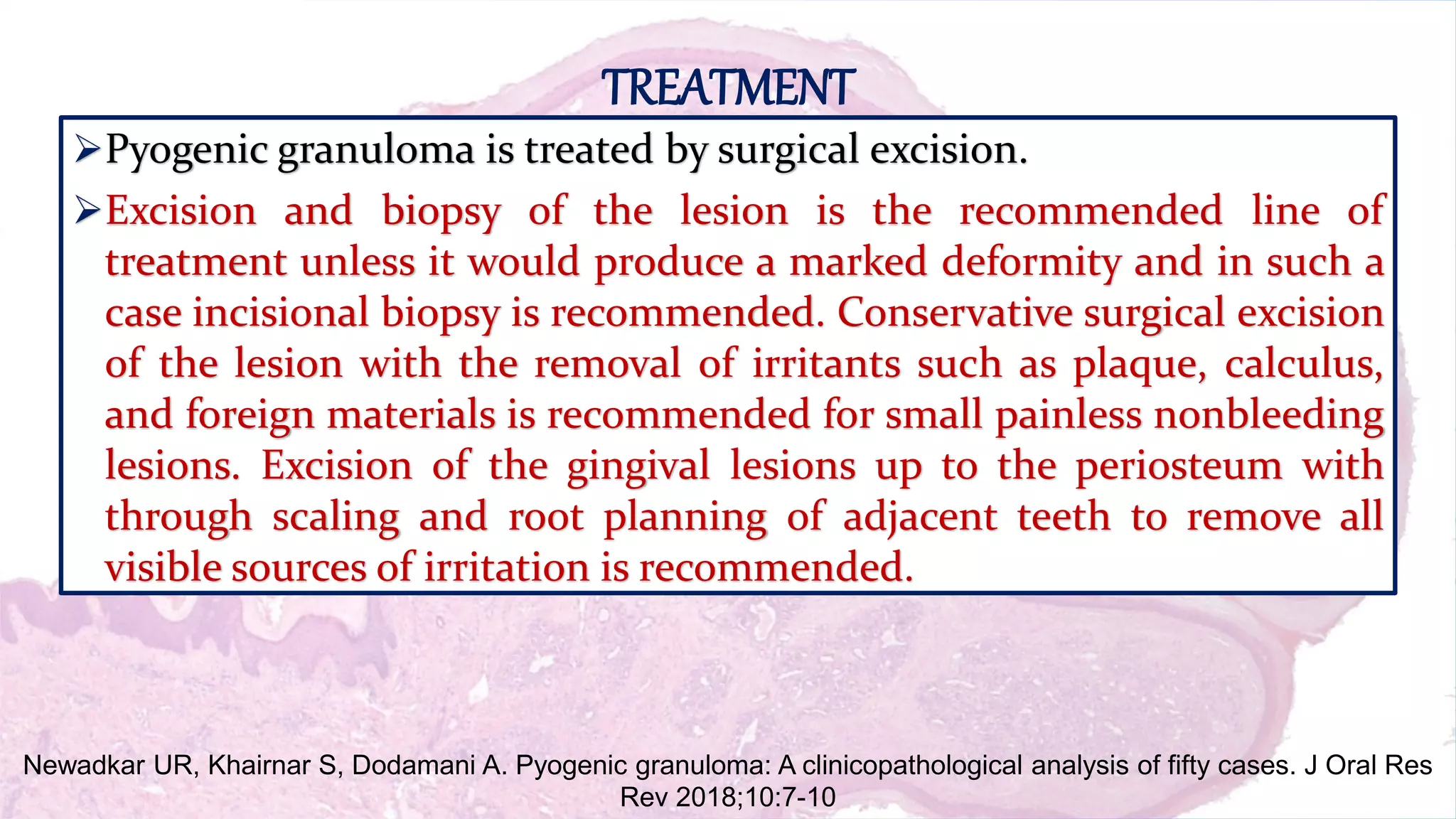 Pyogenic granuloma | PPTX