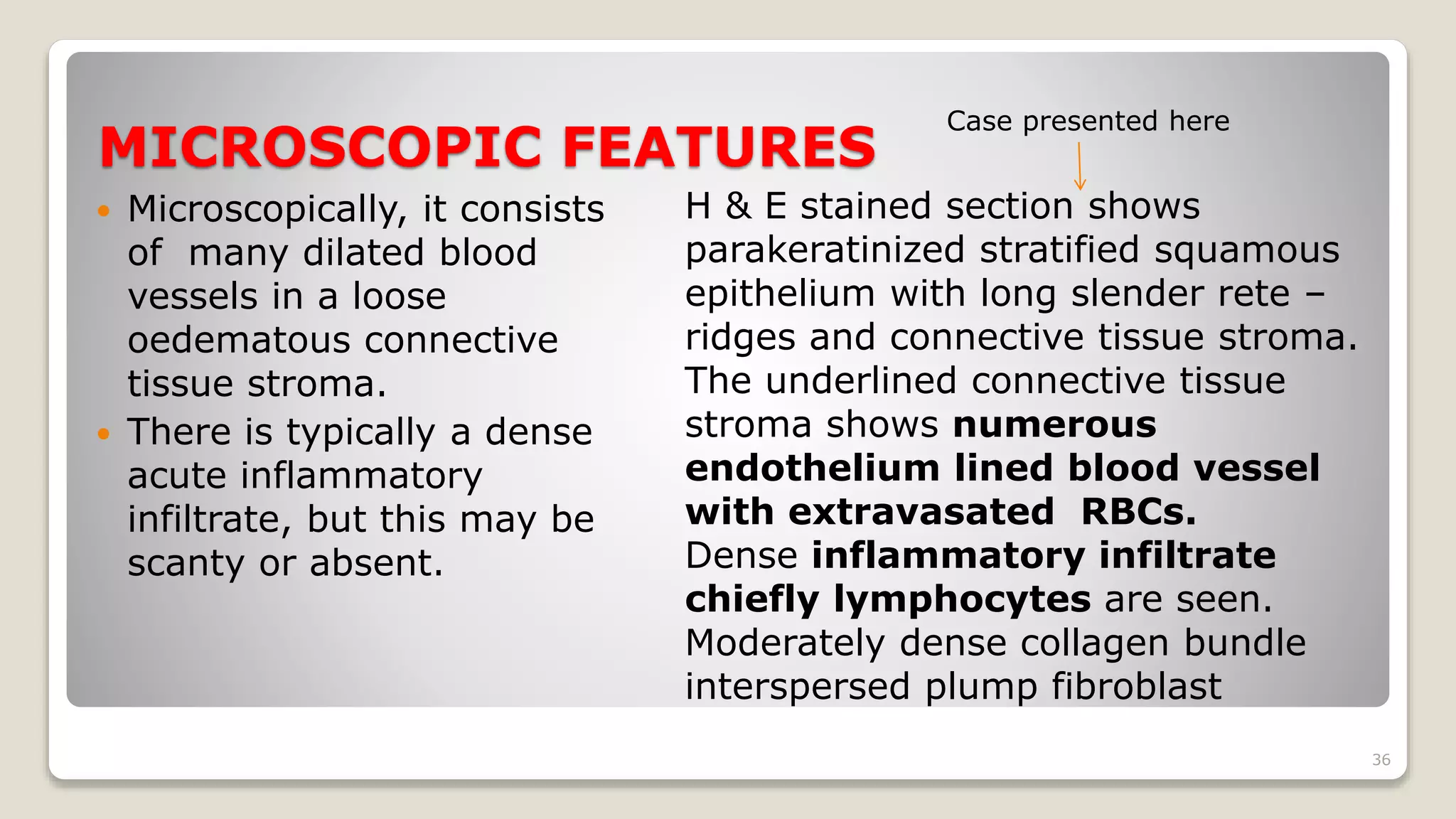 Pyogenic granuloma a case presentation | PPTX