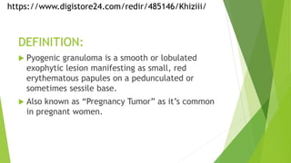 Pyogenic granuloma Presentation | PPTX