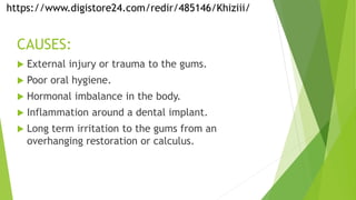 Pyogenic granuloma Presentation | PPTX