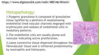 Pyogenic granuloma Presentation | PPTX