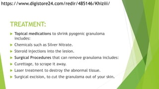 Pyogenic granuloma Presentation | PPTX