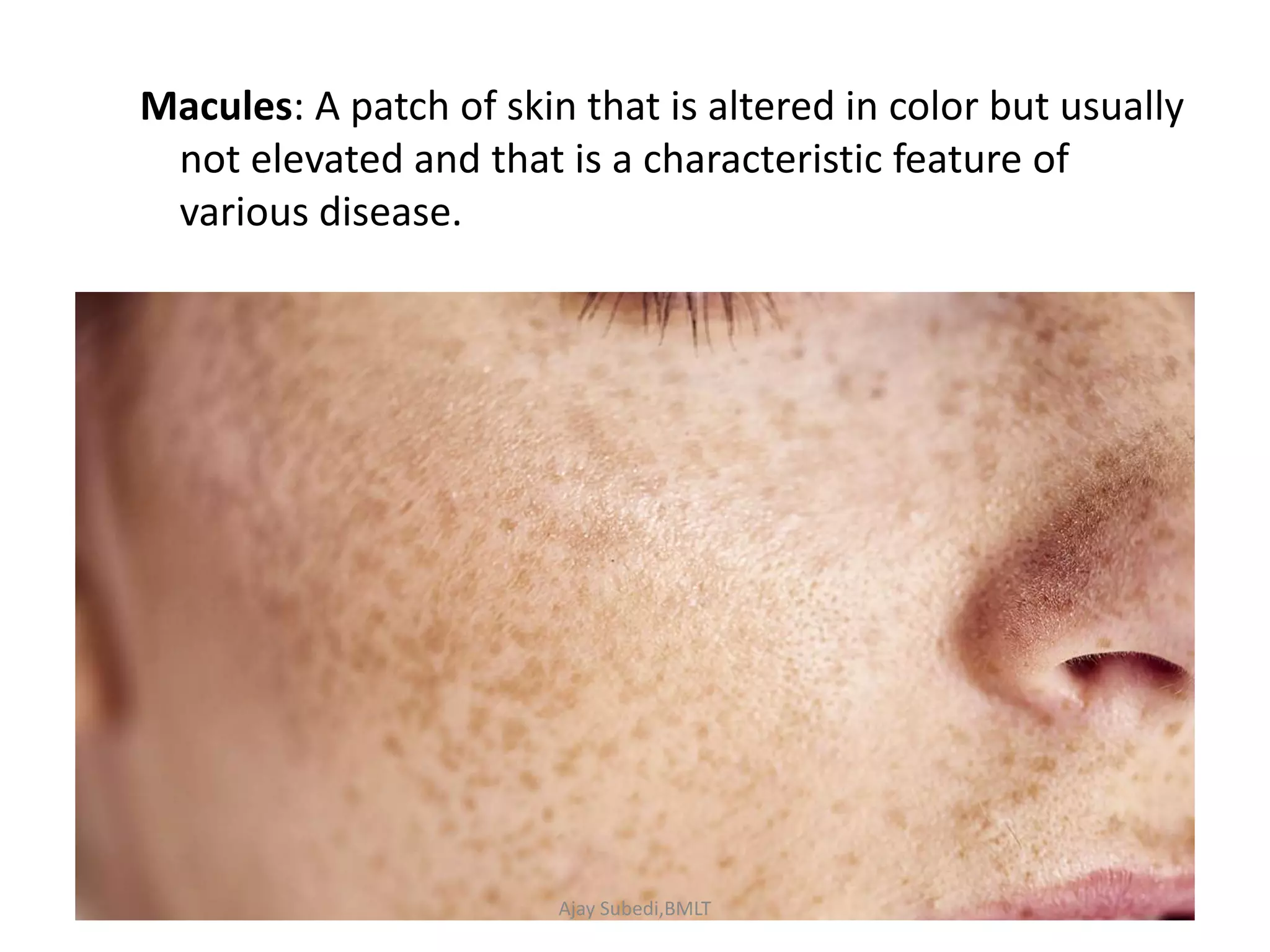 pyogenic infection.pptx