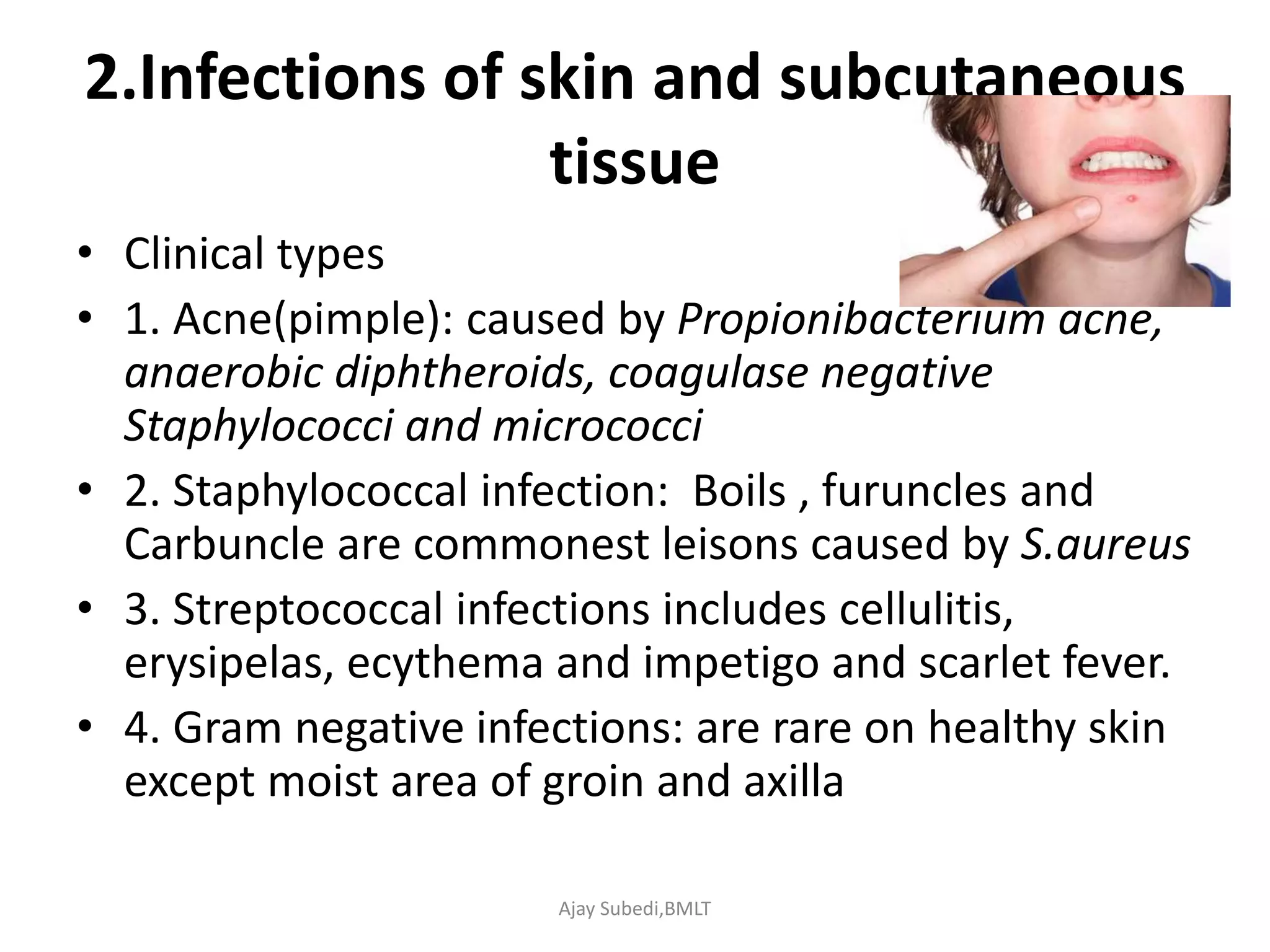 pyogenic infection.pptx