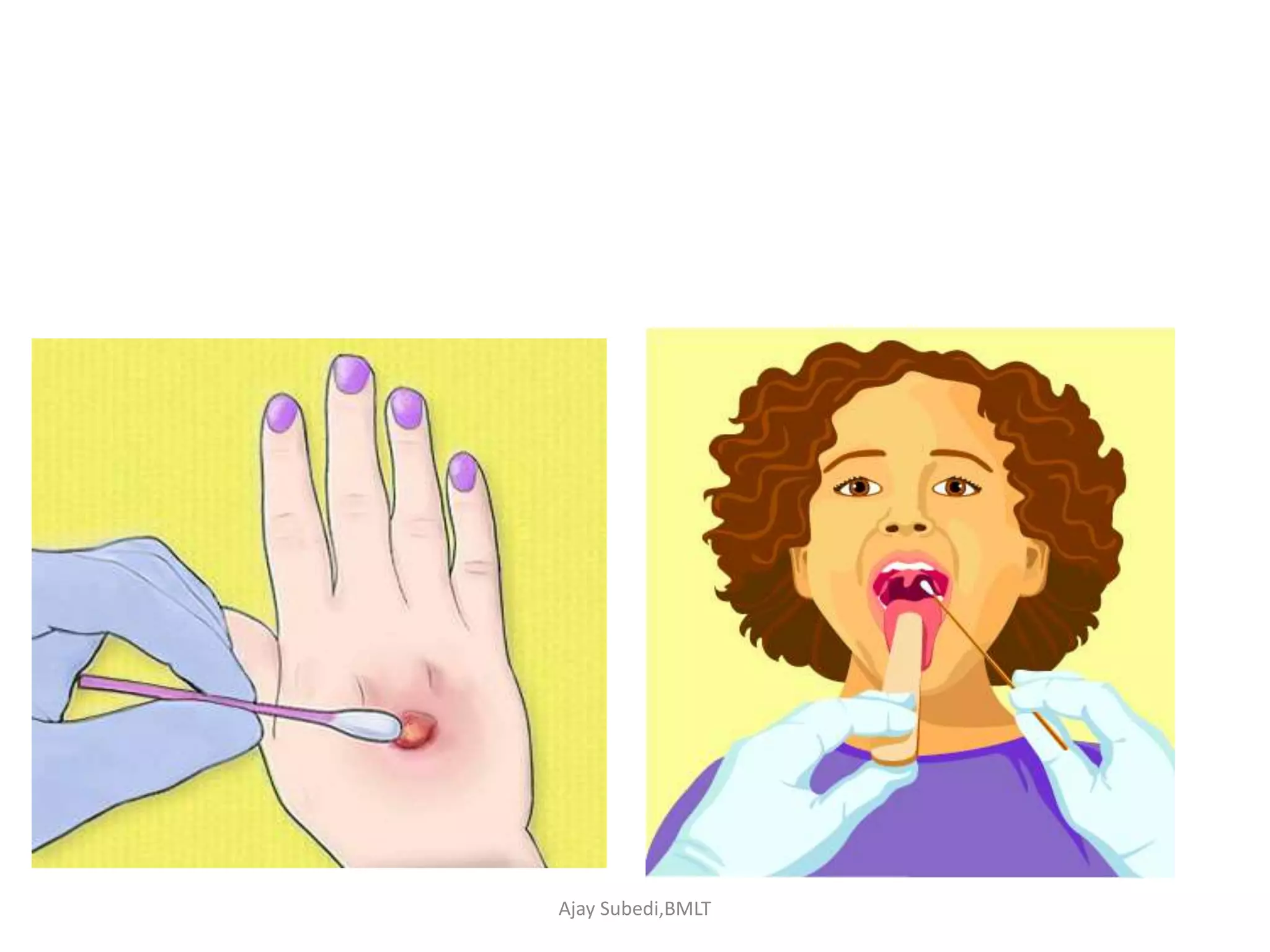 pyogenic infection.pptx