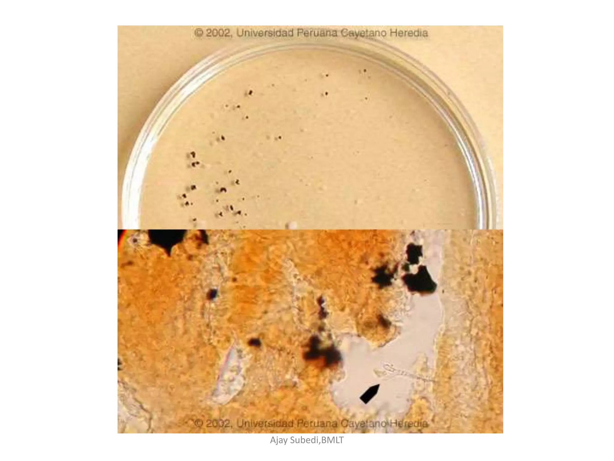 pyogenic infection.pptx