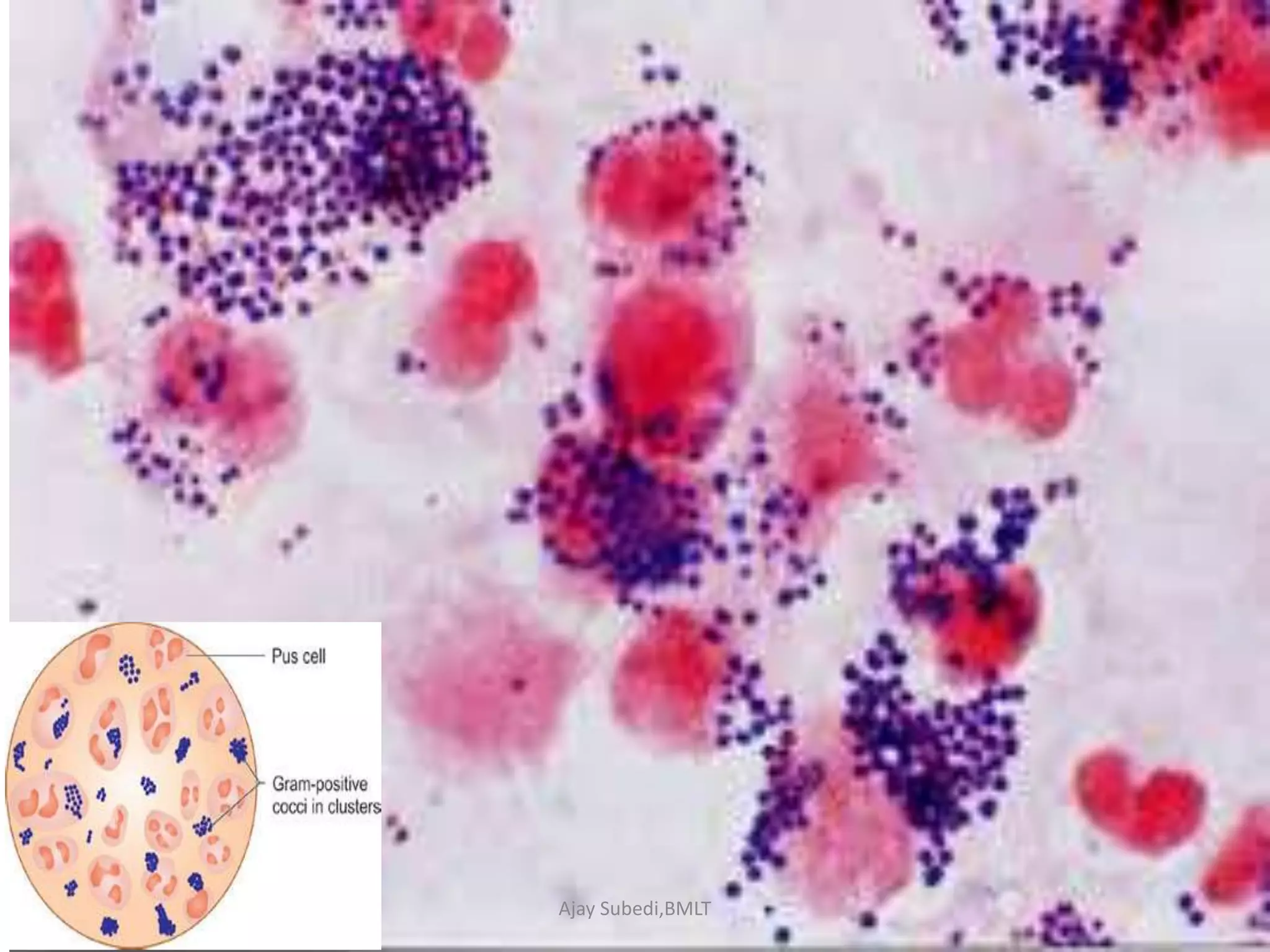 pyogenic infection.pptx