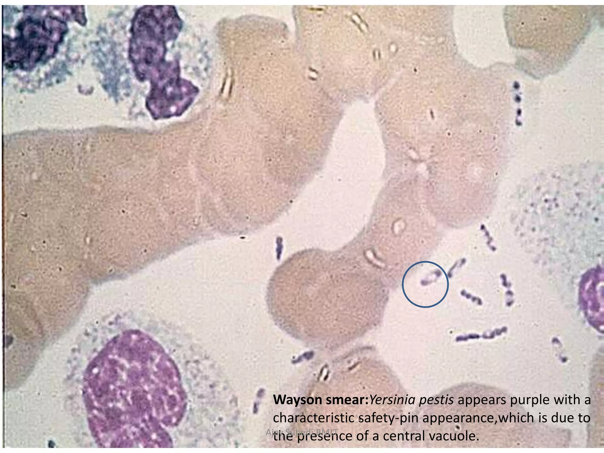 pyogenic infection.pptx