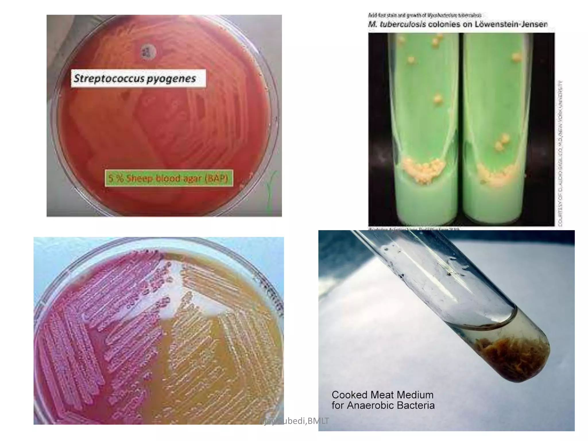 pyogenic infection.pptx