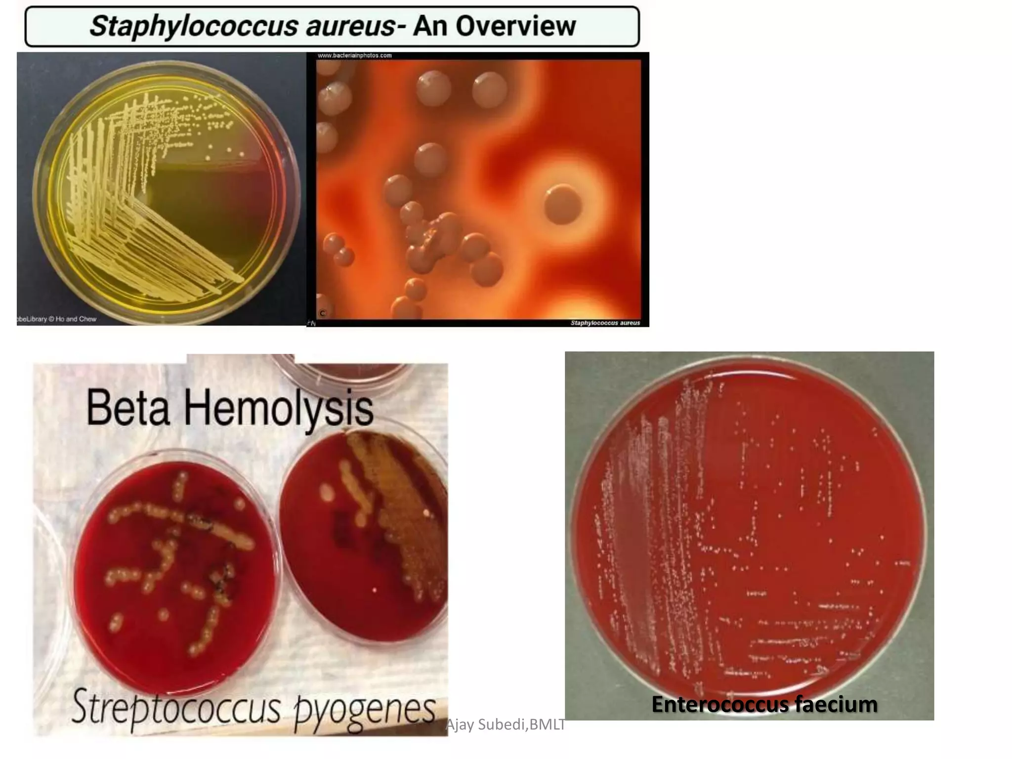 pyogenic infection.pptx