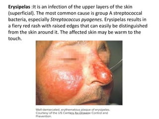 pyogenic infection.pptx