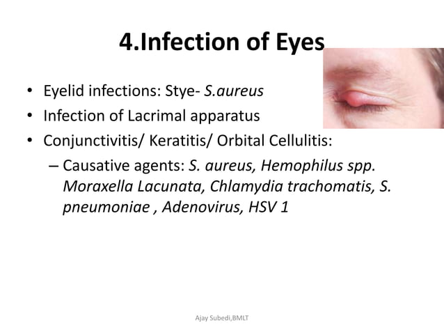 pyogenic infection.pptx | Skin and Dermatology | Diseases and Conditions