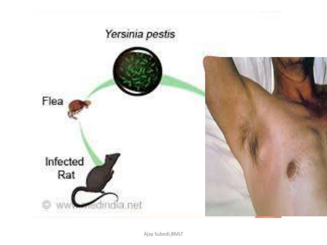 pyogenic infection.pptx | Skin and Dermatology | Diseases and Conditions