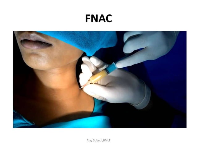 pyogenic infection.pptx | Skin and Dermatology | Diseases and Conditions