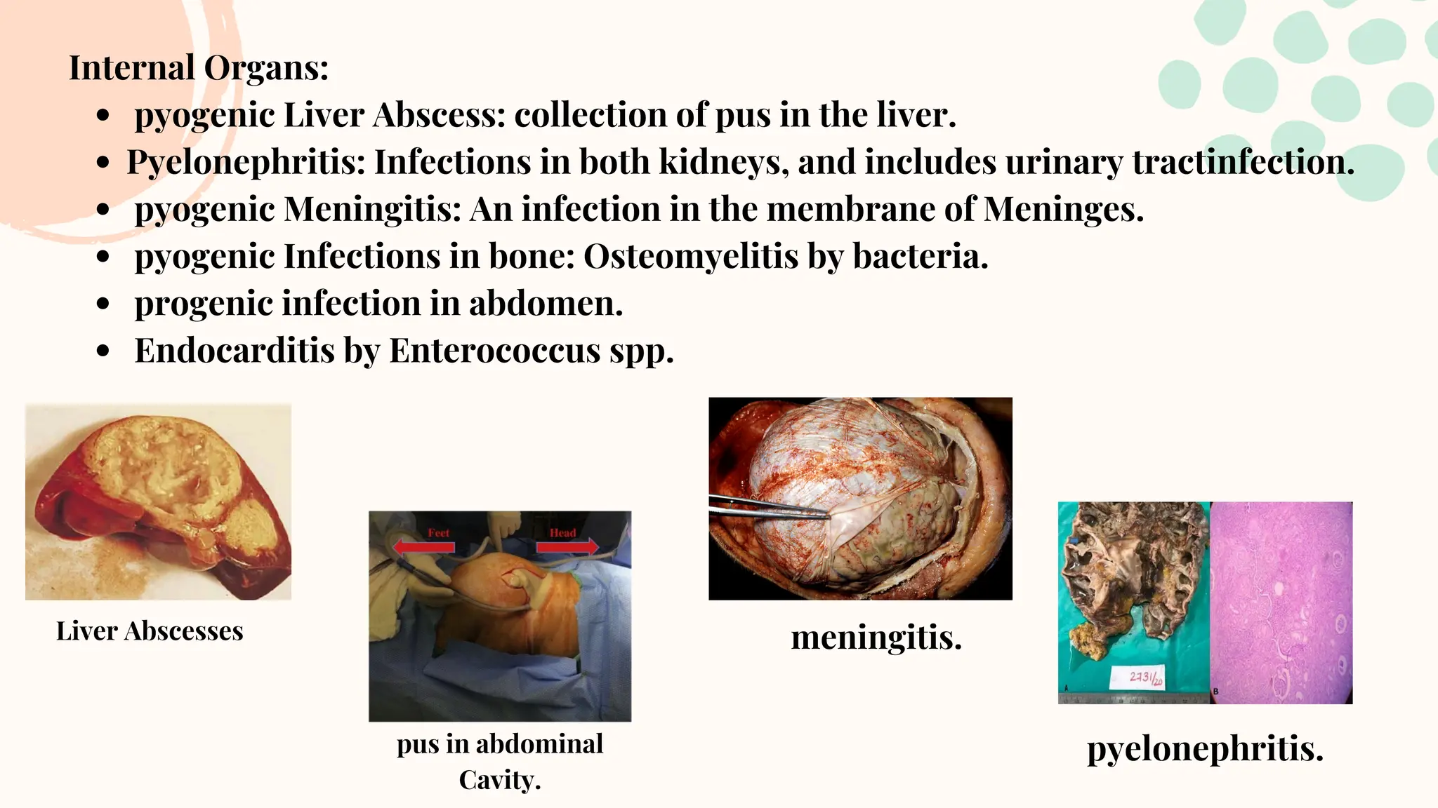 Pyogenic infection by Tharanisha.M _20240425_072415_0000.pdf