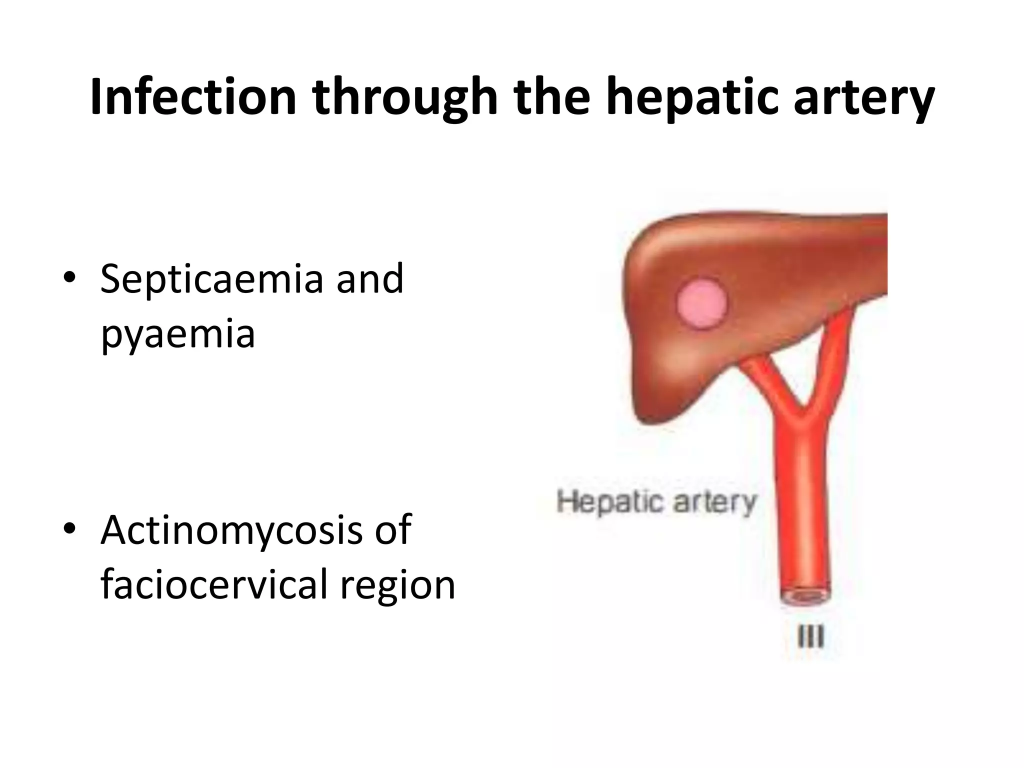 PYOGENIC LIVER ABSCESS.pptx