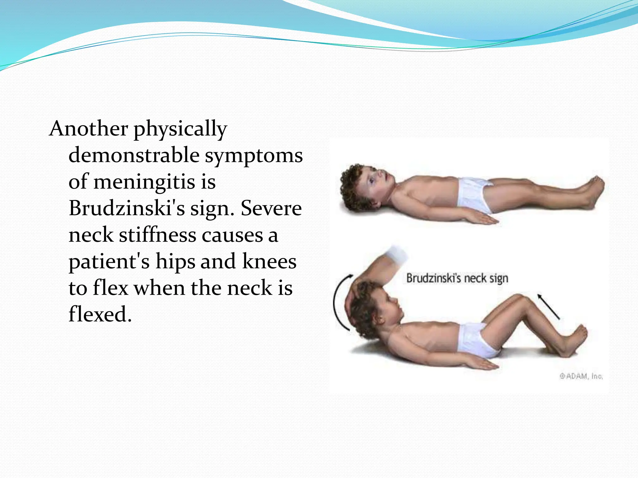 PYOGENIC MENINGITIS.pptx. very common Topic | PPTX