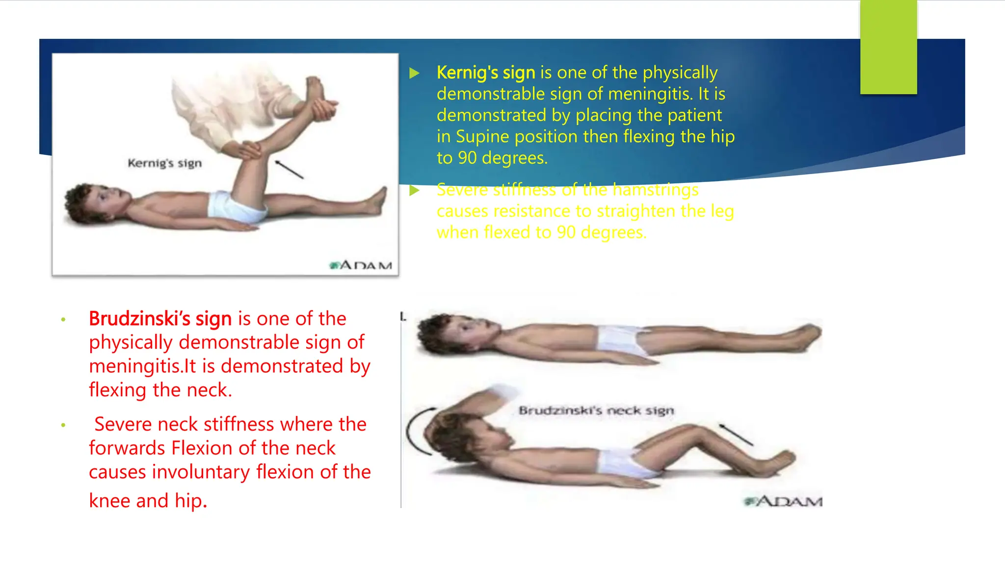 pyomeningitis in pediatric population .pptx