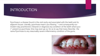 Pyorrhea | PPTX | Oral care | Personal Care