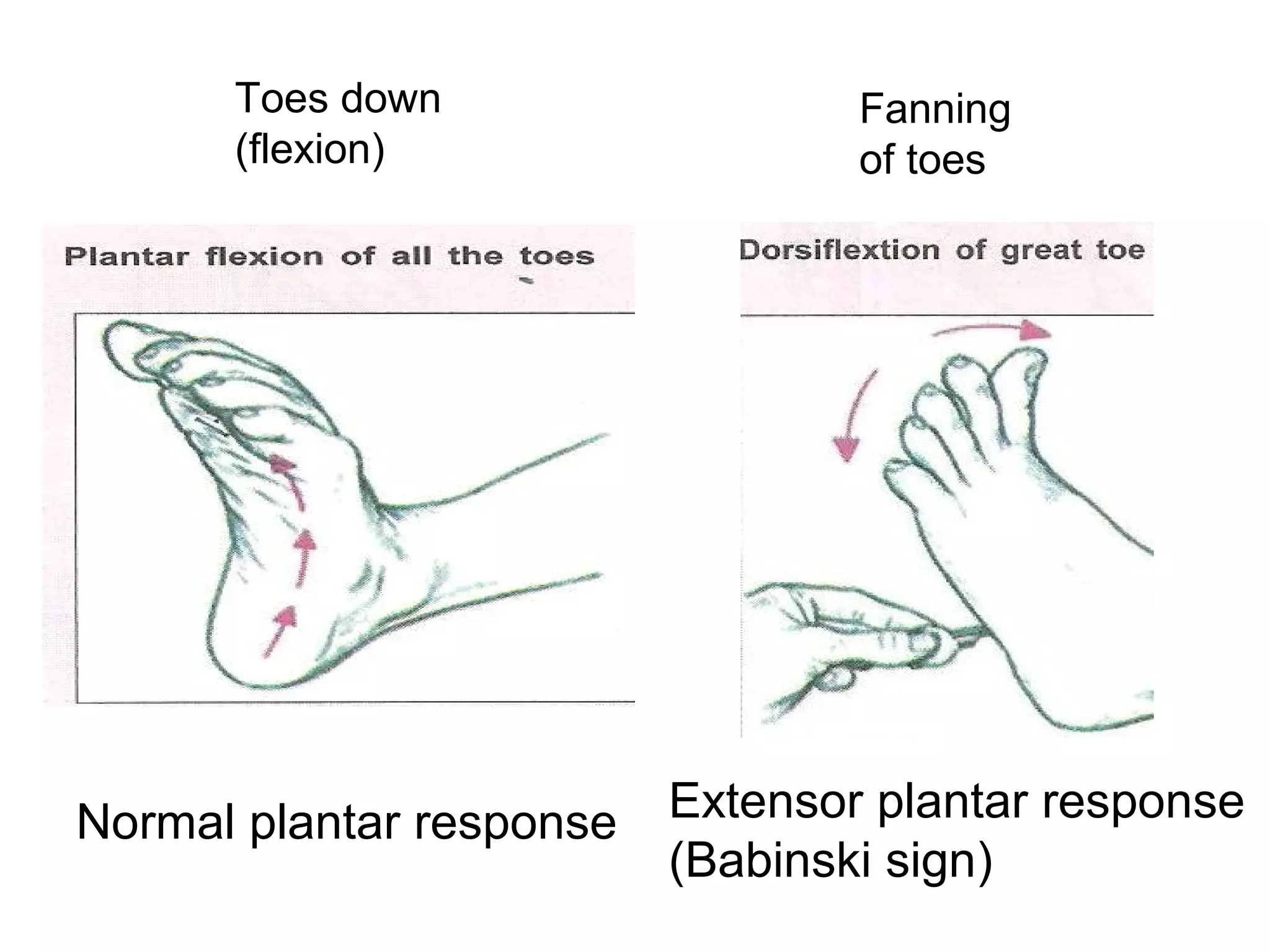 Pyramidal tract by Sunita.M.Tiwale,Prof. Dept of physiology,D.Y.Patil ...