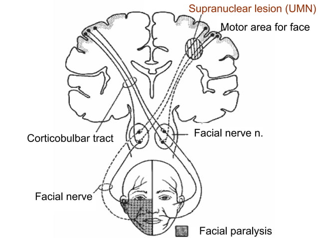Pyramidal tract by Sunita.M.Tiwale,Prof. Dept of physiology,D.Y.Patil ...