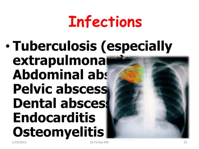 Pyrexia of unknown origin | PPTX