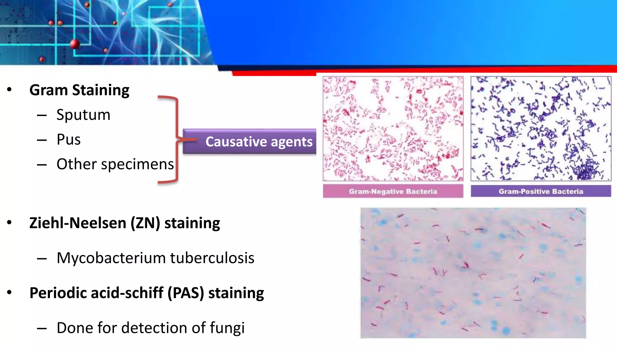 Pyrexia of Unknown Origin | PPTX