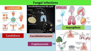 Pyrexia of Unknown Origin | PPTX