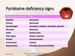 Pyridoxine deficiency and toxicity | PPSX