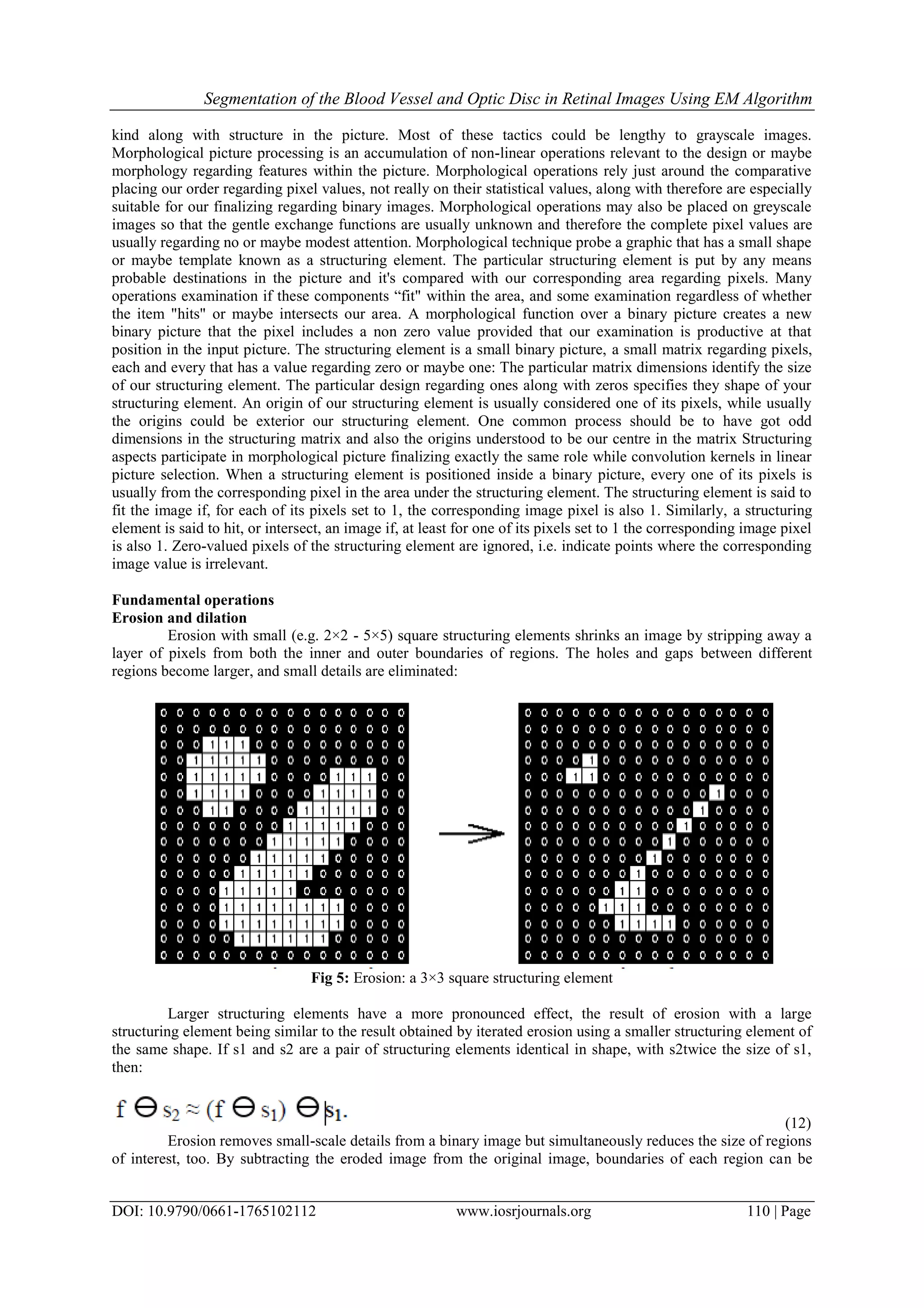 Segmentation of the Blood Vessel and Optic Disc in Retinal Images Using EM Algorithm | PDF