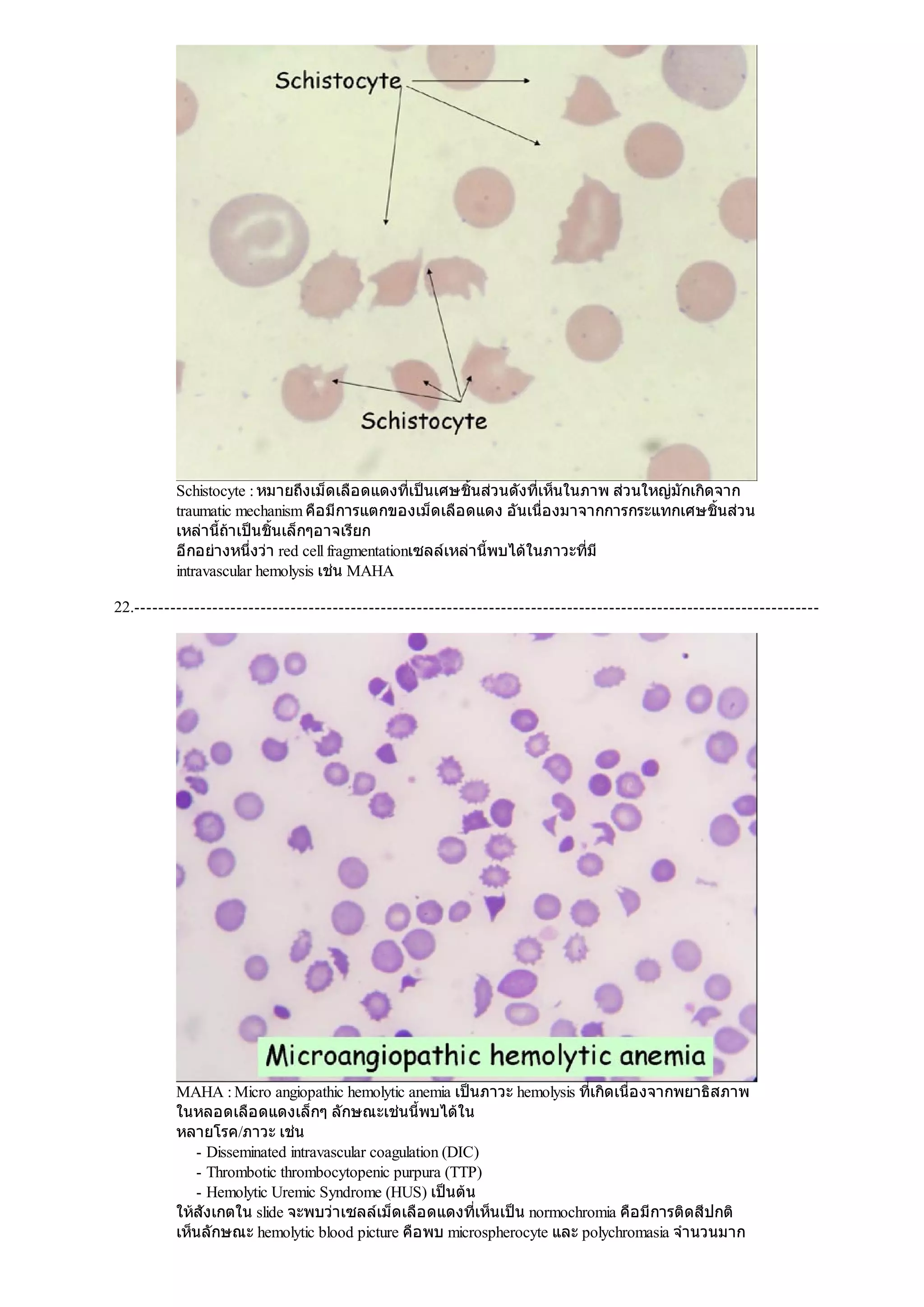Peripheral blood smear | PDF